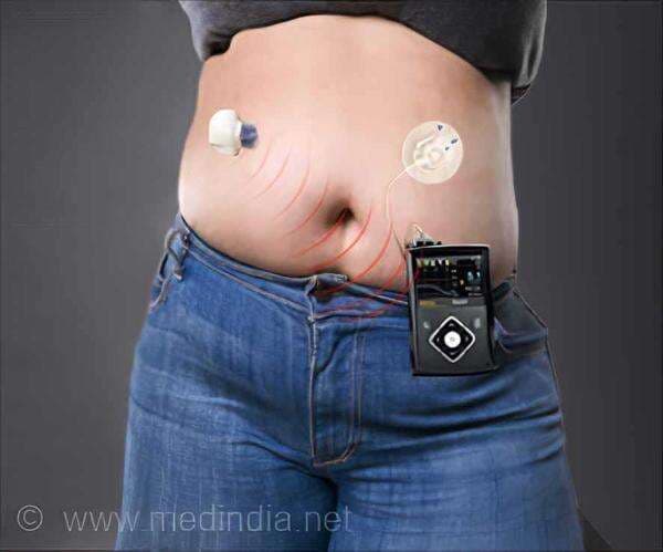 Algoritma Kompleks Atur Volume Penyuntikan Insulin | News+ on RCTI+